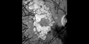 Visionix | SOLIX Platform for Superior Diagnostic Experience