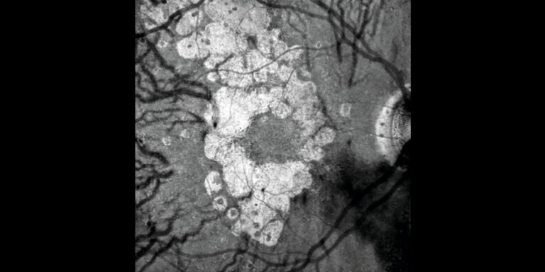 Visionix | SOLIX Platform for Superior Diagnostic Experience