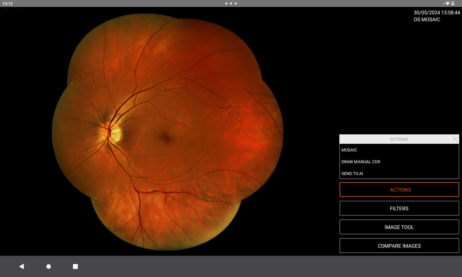 VX 610 Automated Fundus Camera - Visionix