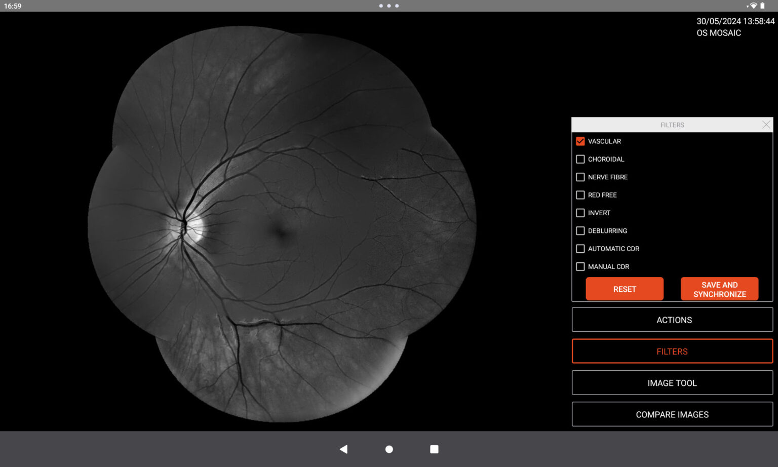 VX 610 Automated Fundus Camera - Visionix