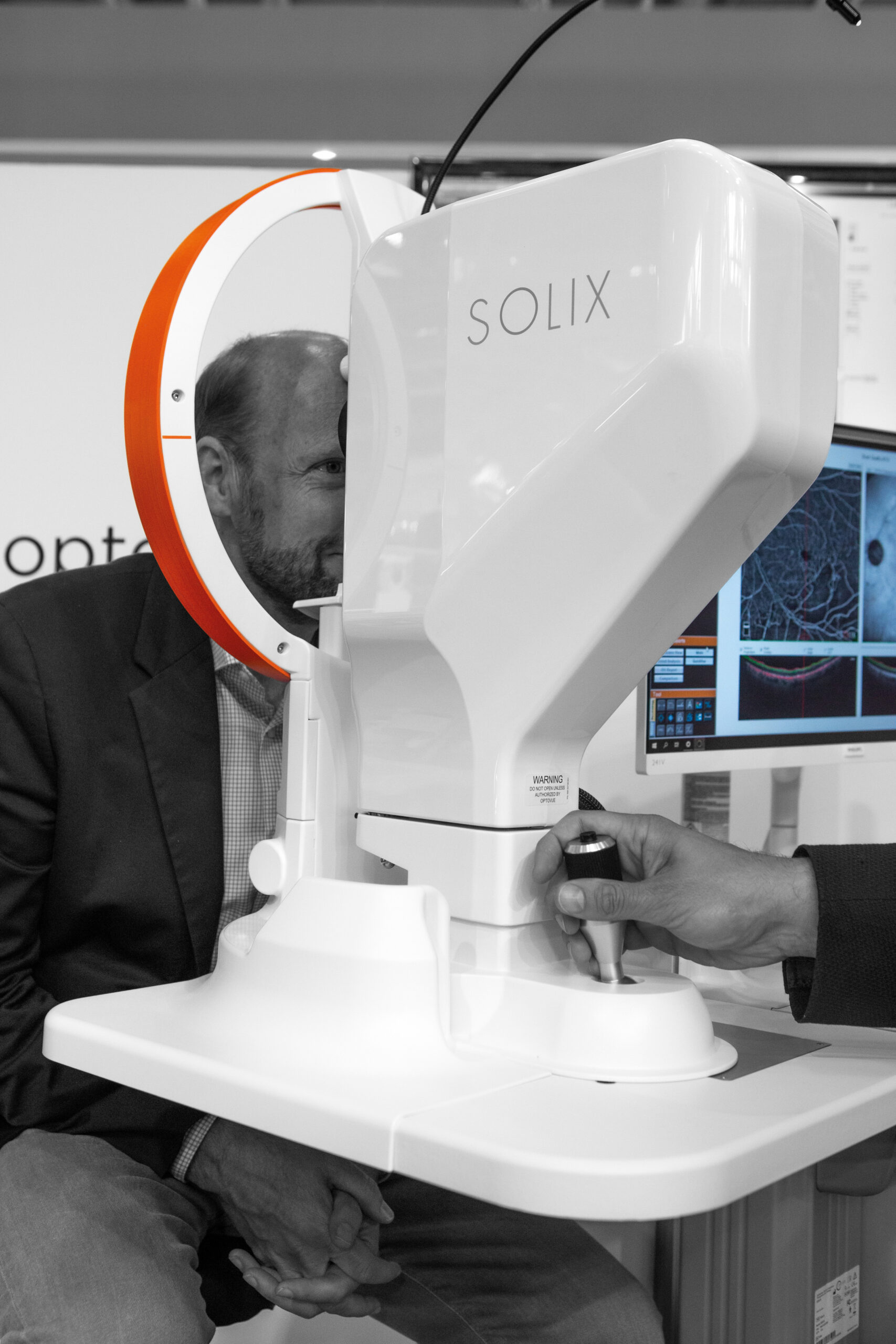 [Showcase] Optovue Solix Essential - Visionix