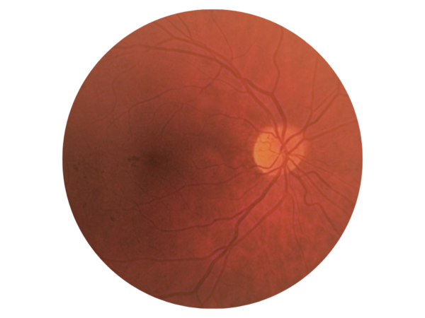 Visionix | VX 650 allows anterior-posterior examination
