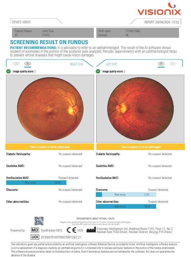 Visionix | Retina screening